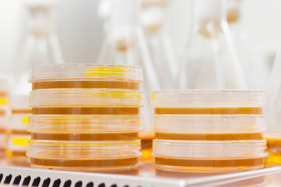 How to Make Agar Plates for Mushroom Cultivation