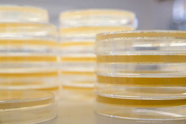 How to Make Agar Slants for Mushroom Cultures